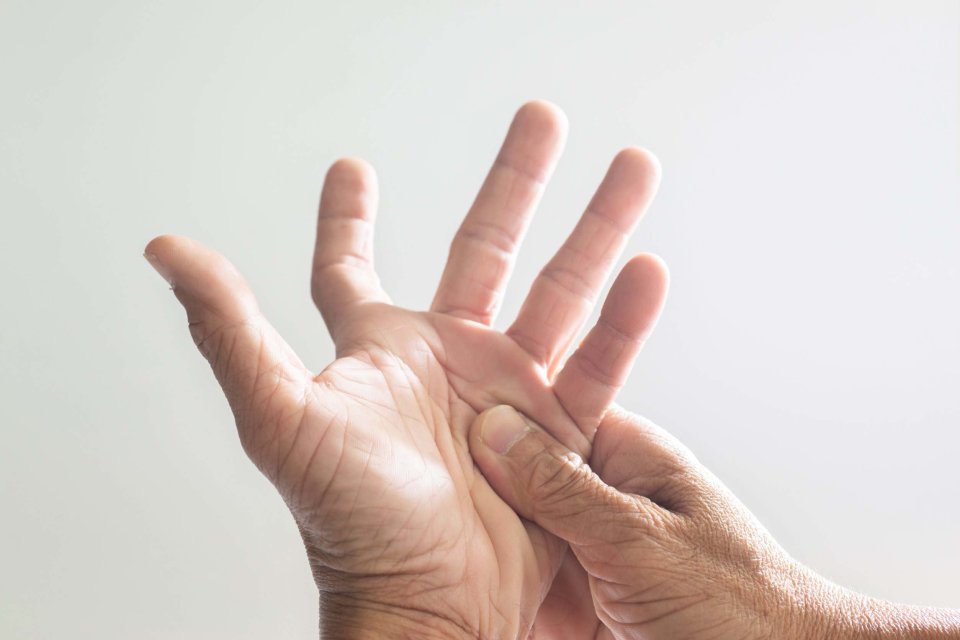 Morbo di Dupuytren: sintomi, cause e trattamento