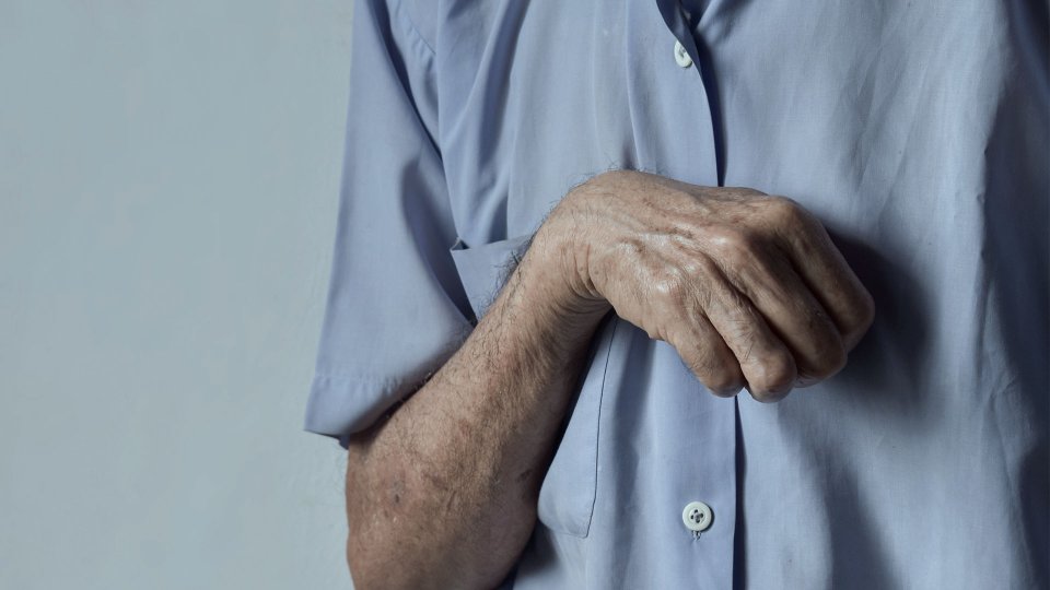 Spasticità degli arti superiori e inferiori